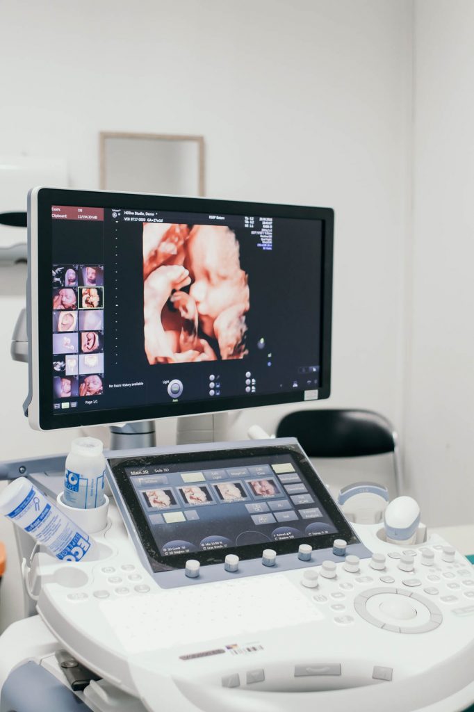 USG 4D – RSBP Batam